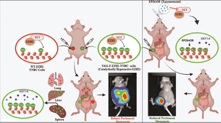Researchers find novel way to target Triple-Negative Breast Cancer ...