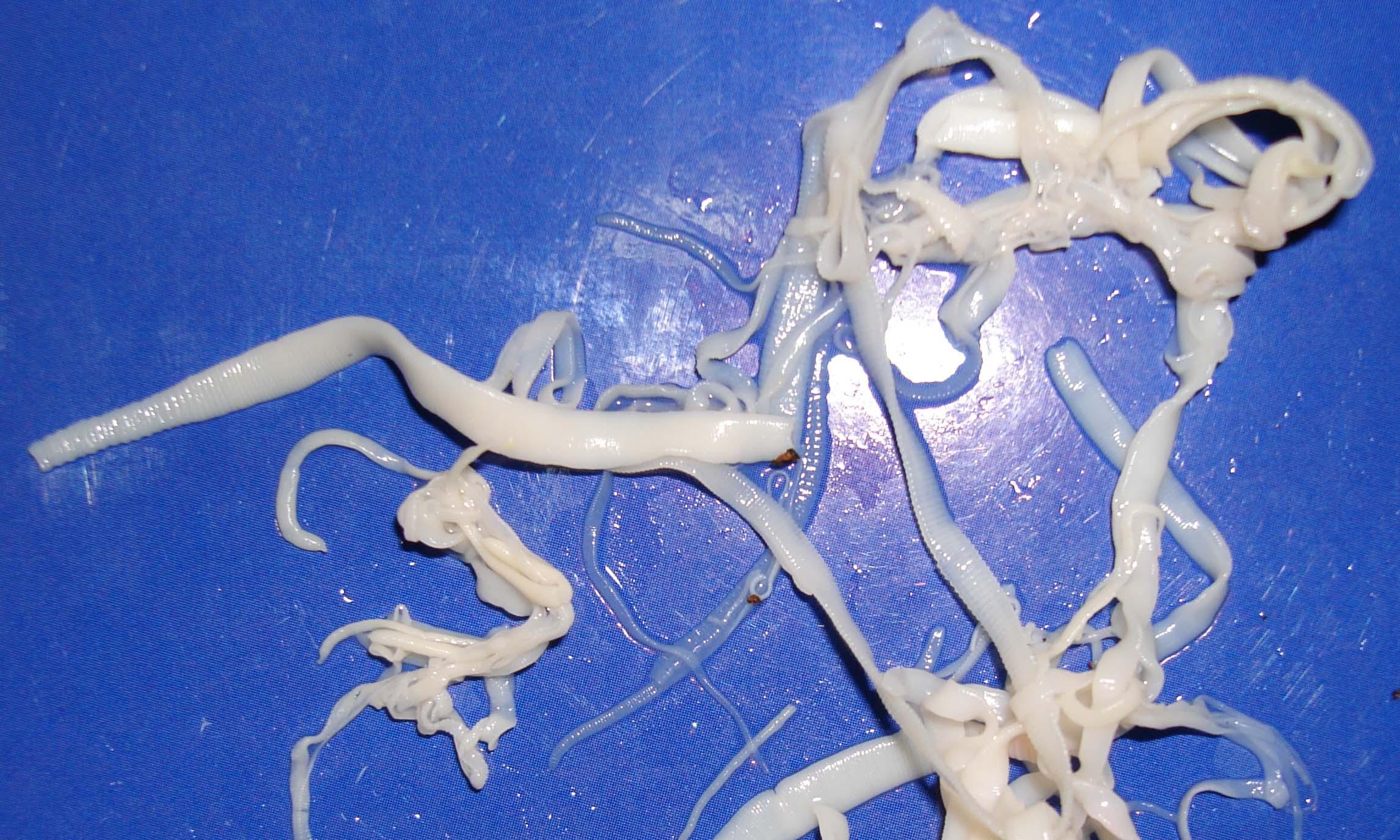 How tapeworm can enter the brain, and how you can prevent it