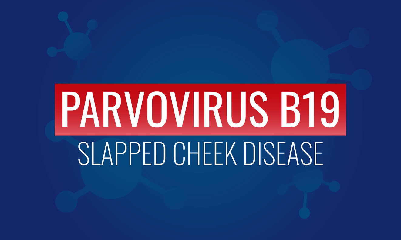 Parvovirus B19 or ‘slapped cheek’ illness: All you need to know as ...